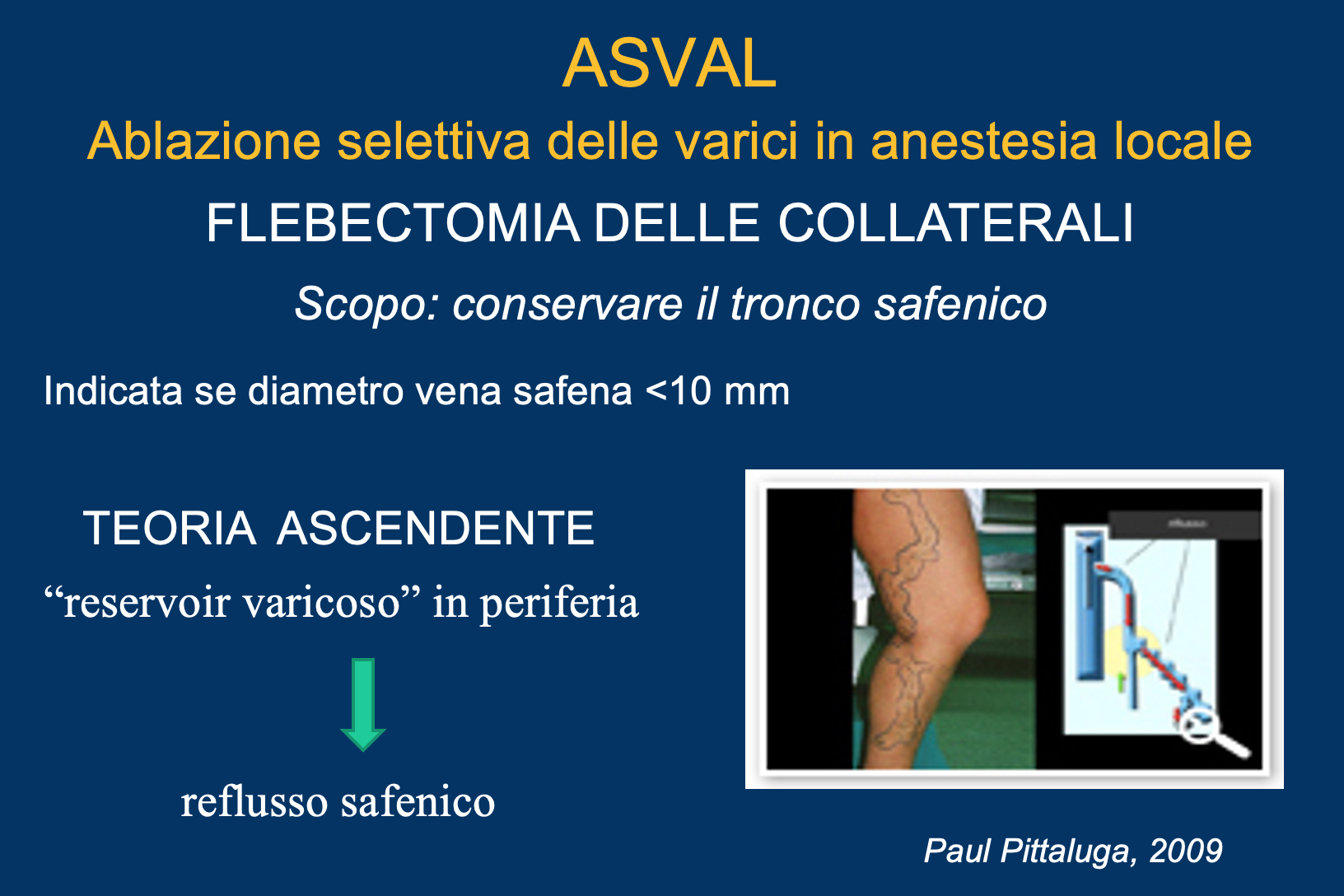 Trattamento chirurgico patologia venosa – Dottor Natalicchio