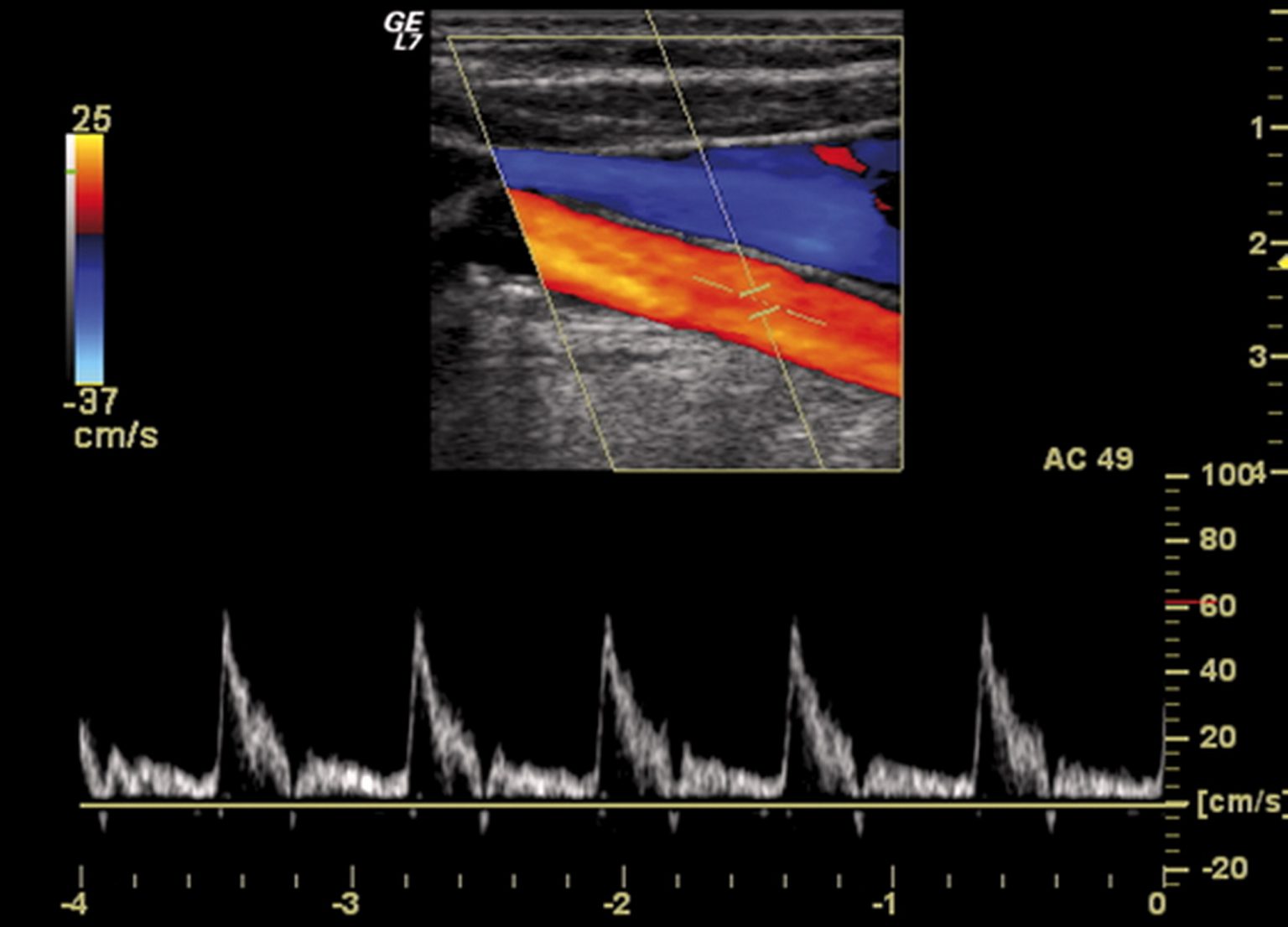 Diagnostica vascolare: l’Eco color doppler – Dottor Natalicchio